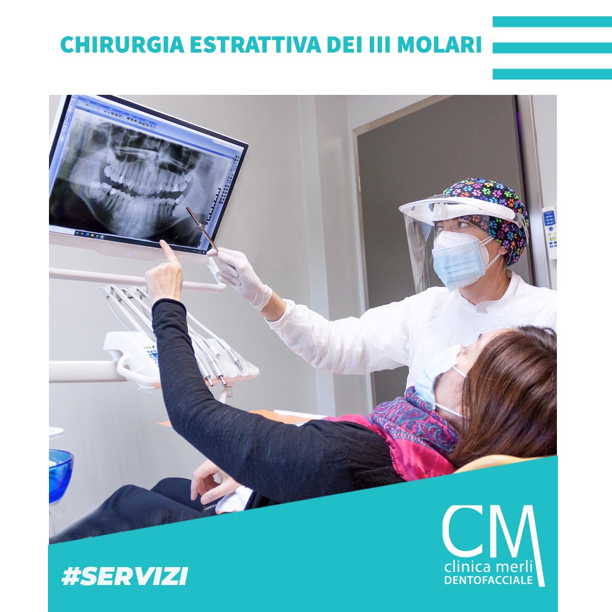 L’estrazione dei terzi molari “denti del giudizio” - Clinica Merli ...